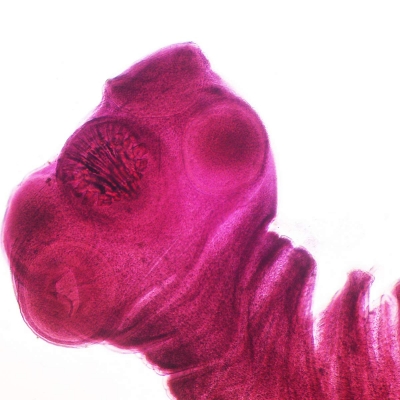 Prepared Microscope Parasitology Slides for Medical Education - Warp ...